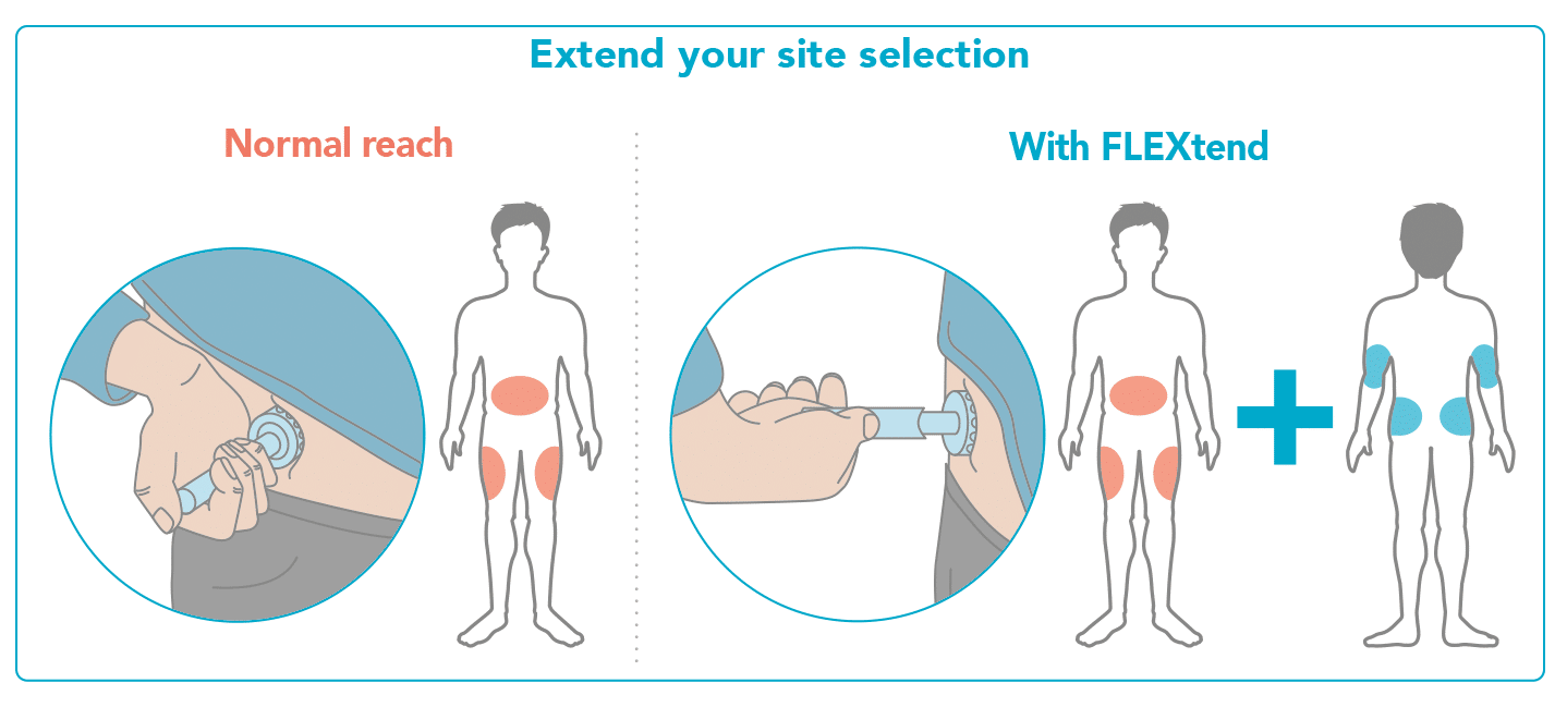 FlexTend for Use with TickleFlex - Diabetic Outlet